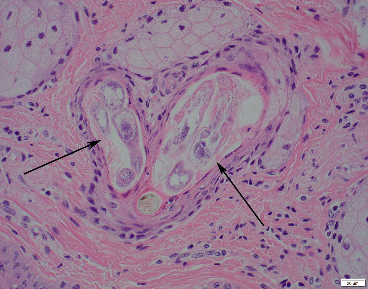 Demodex mites associated with alopecia in deer | Dutch Wildlife Health ...