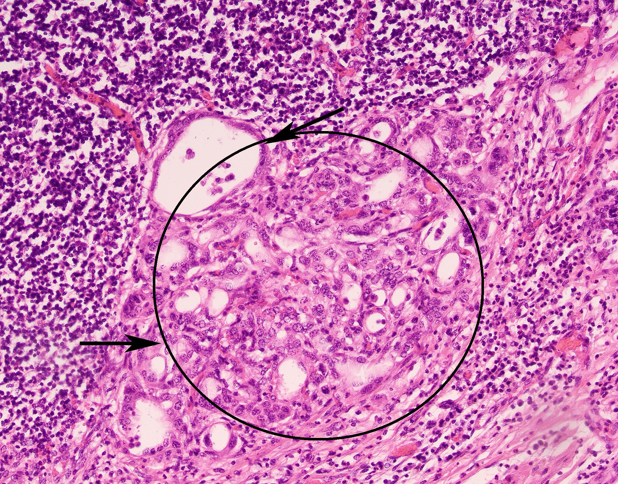 Breast lump in roe deer due to sweat gland cancer | Dutch Wildlife ...